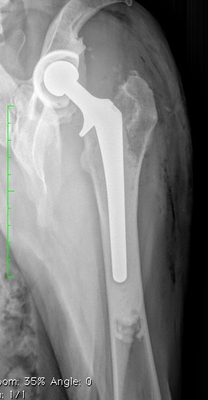 Total Hip Replacement | ACOSM | Arizona Canine Orthopedics & Sports ...