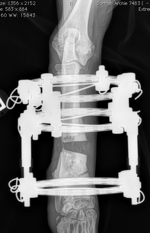 Orthopedic Trauma & Minimally Invasive Fracture Repair - Arizona Canine Orthopedics & Sports ...